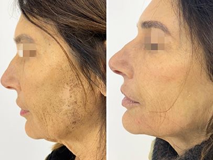 Photo Gallery | Volure MedSpa